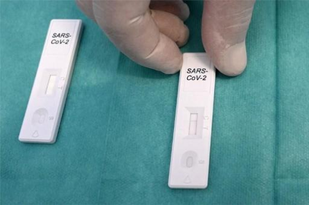 Des tests rapides dans les pharmacies sont possibles avec une bonne ...